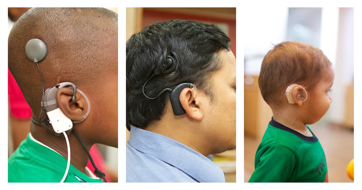 Baha Hearing Aid How It Works at Irene Rayburn blog