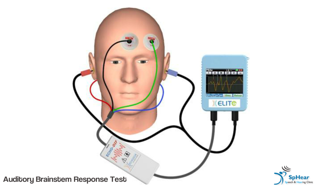 Auditory Brainstem Response Test in Delhi, Noida & Patna | SpHear Clinic