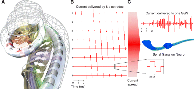 Neural Response Telemetry- NRT / NRI / ART | SpHear Speech & Hearing ...