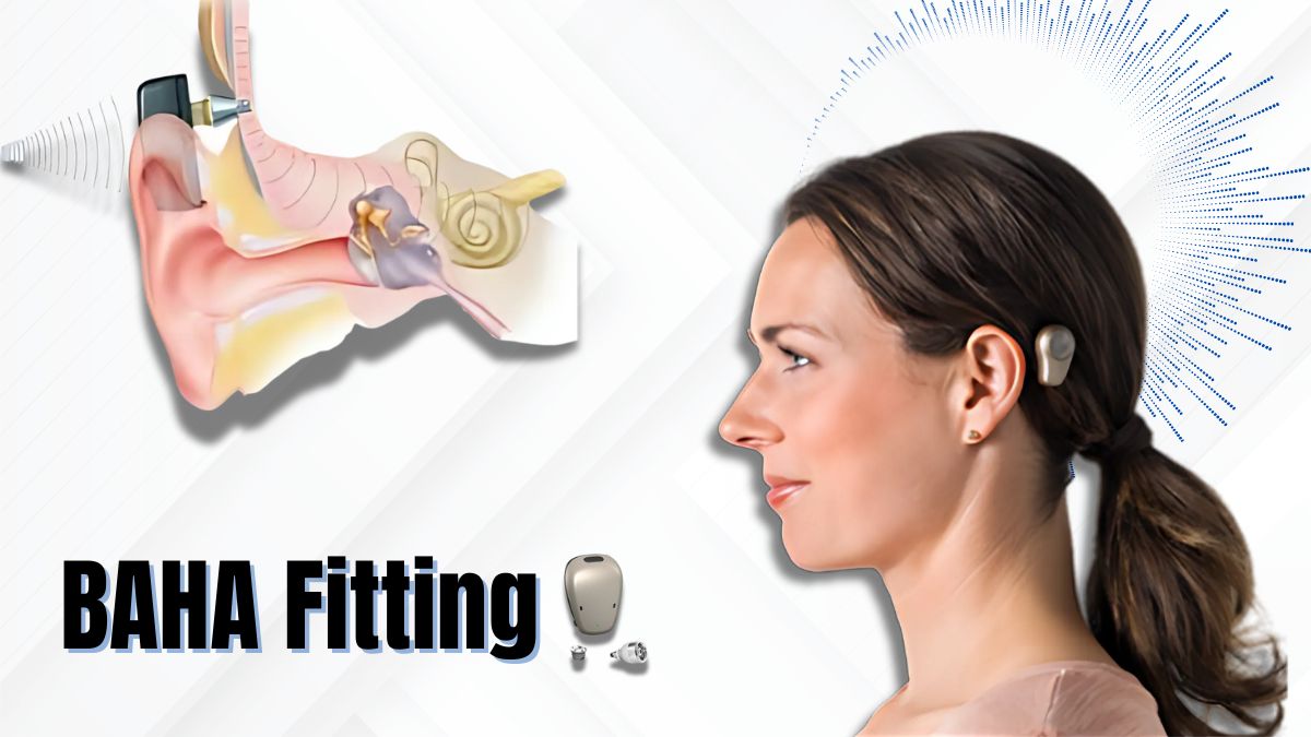 BAHA Fitting in Delhi | Best Bone Anchored Hearing Aid Care