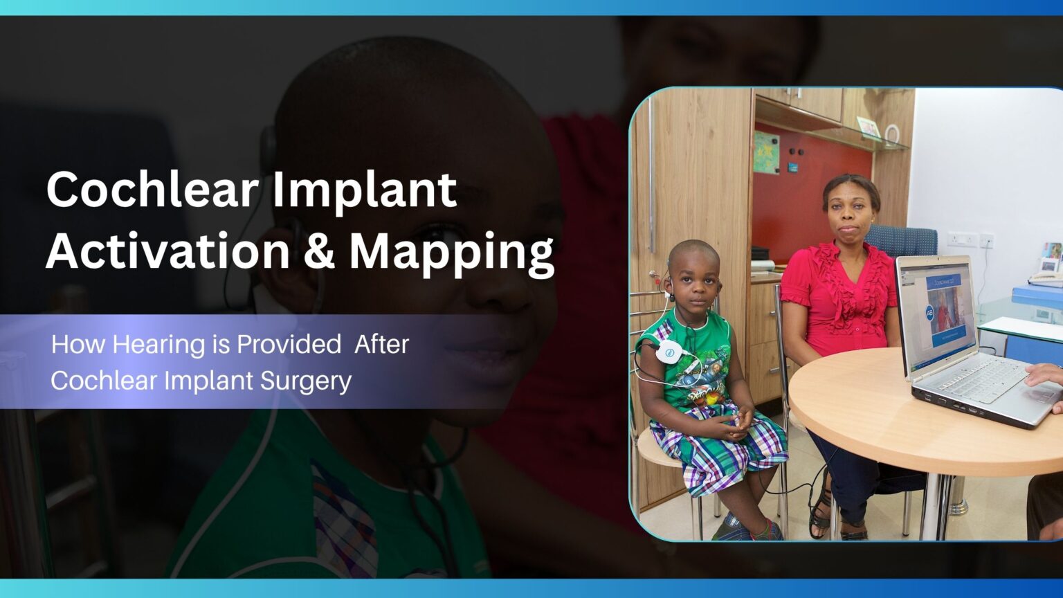 Cochlear Implant Switch-On & Mapping Process Explained | SpHear Clinics